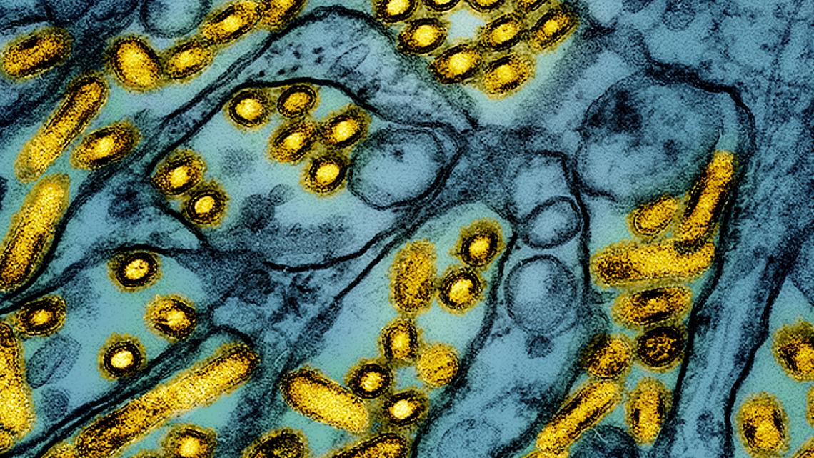 Bird Flu in California: Child in Alameda County infected | cbs8.com