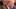 Trump's red neck caused by 'common skin cream,' White House says | cbs8.com