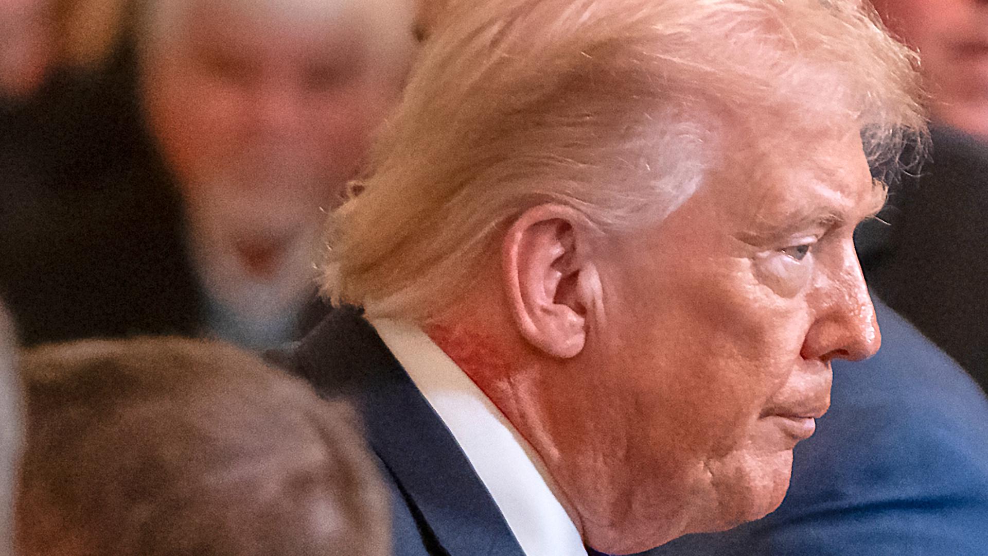 Trump's red neck caused by 'common skin cream,' White House says | cbs8.com