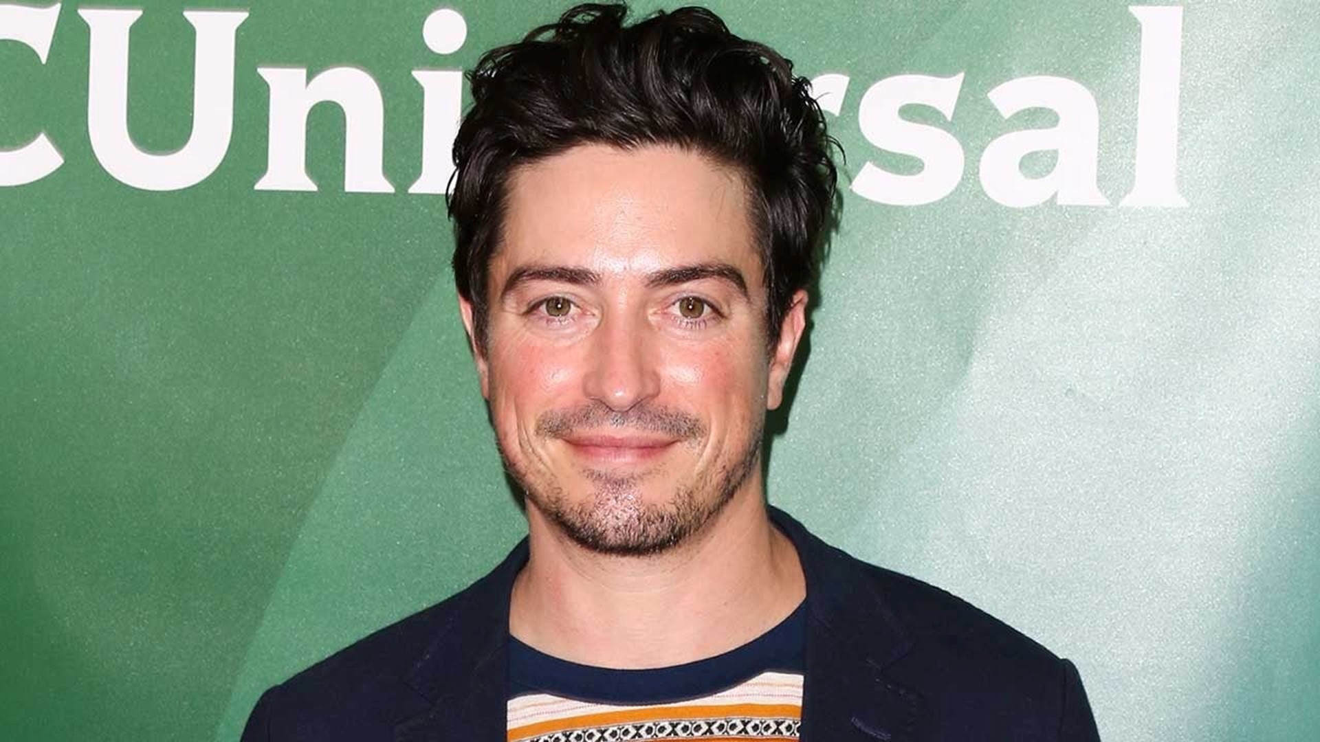 'Superstore' Actor Ben Feldman Reveals He Underwent Spinal Surgery ...