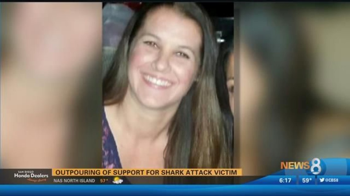 Shark Attack: Doctors say victim is a fighter | cbs8.com