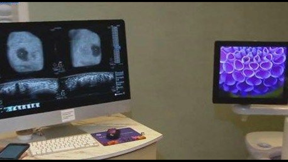 New mammogram machine puts women in control | cbs8.com