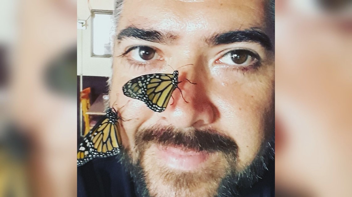 Zevely Zone: Introducing the 'Butterfly Face' man | cbs8.com
