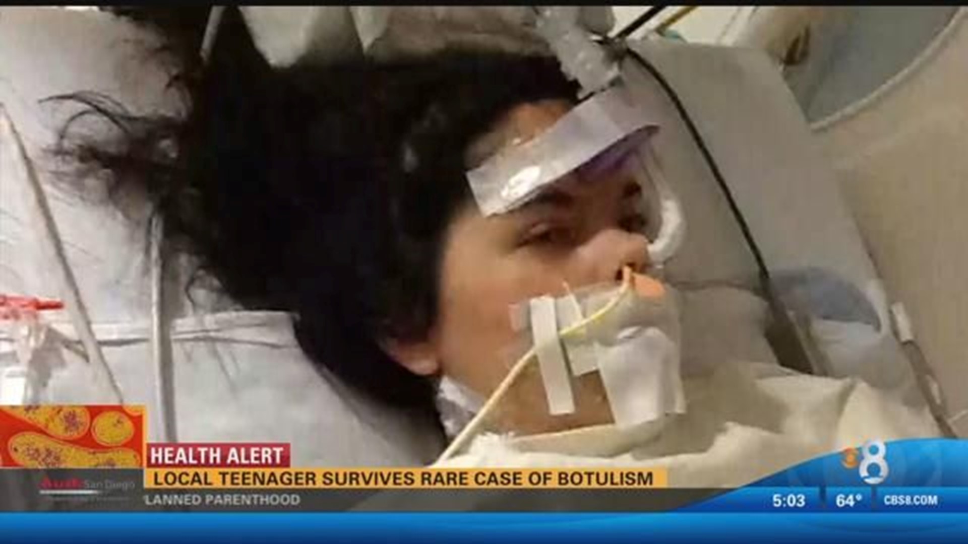 Escondido teen survives rare case of botulism | cbs8.com