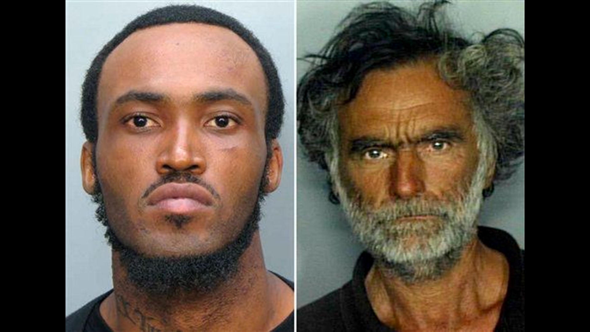 Even police shocked by gore in face-mauling attack | cbs8.com