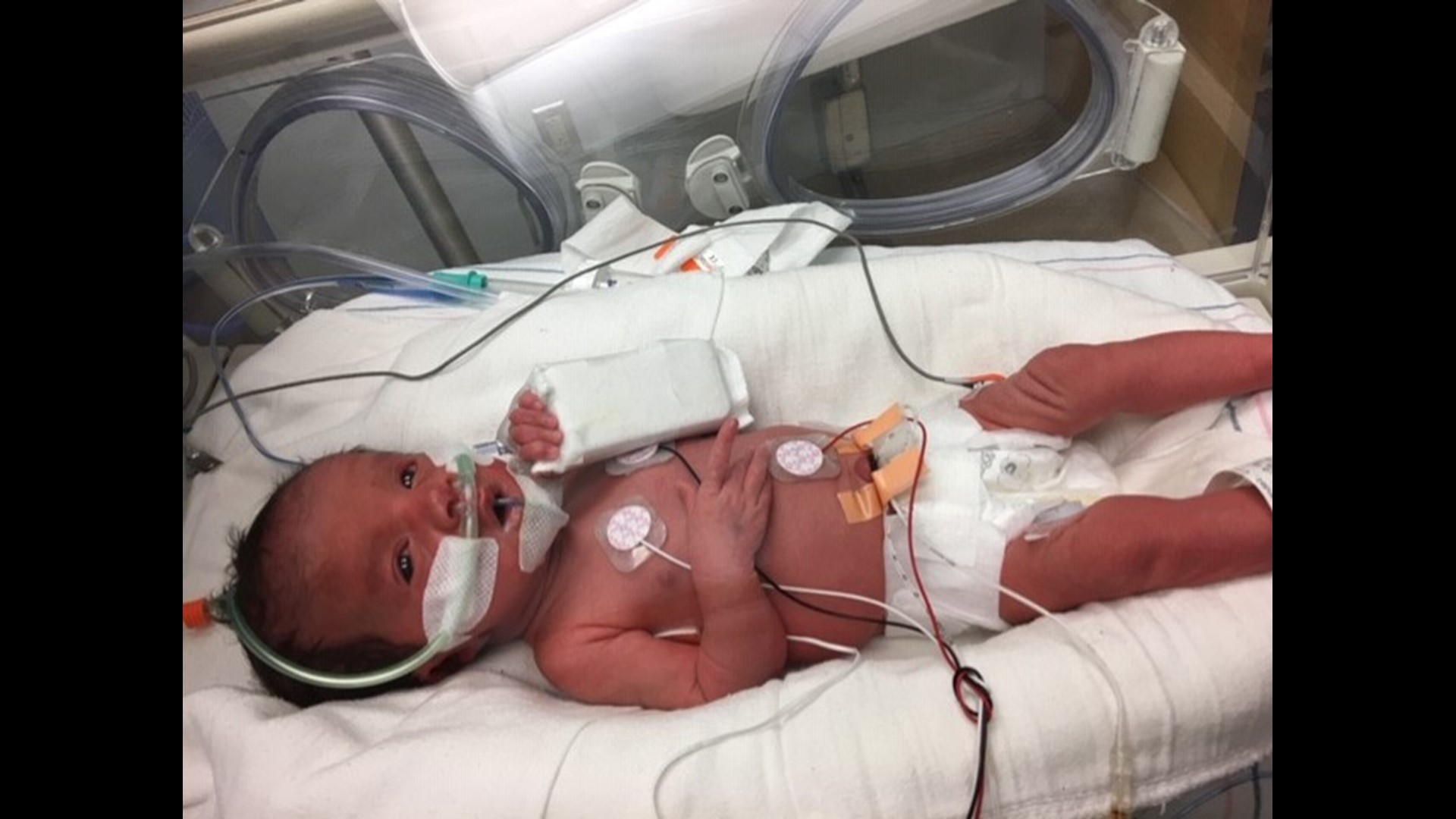 'Miracle Babies' helps families with NICU infants | cbs8.com