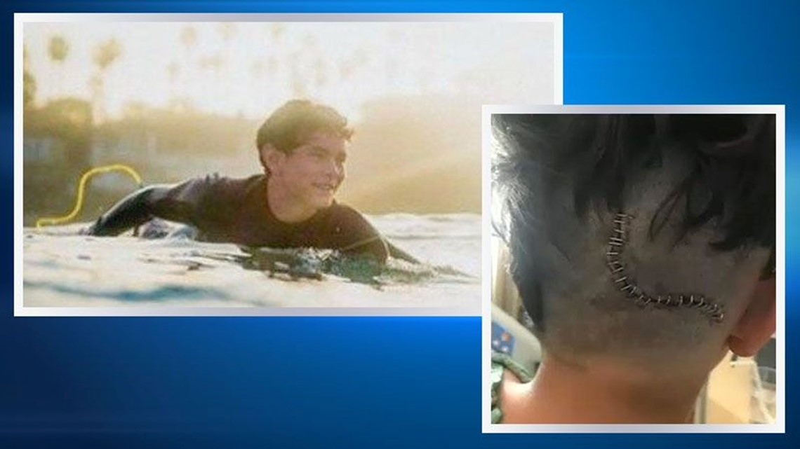 San Diego surfer recovering from freak accident after surfboard impales ...