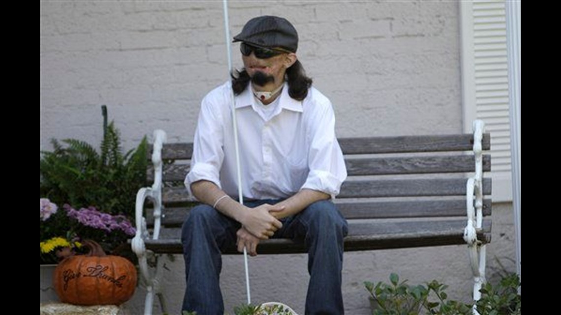 Badly burned Texas man waits for face transplant | cbs8.com