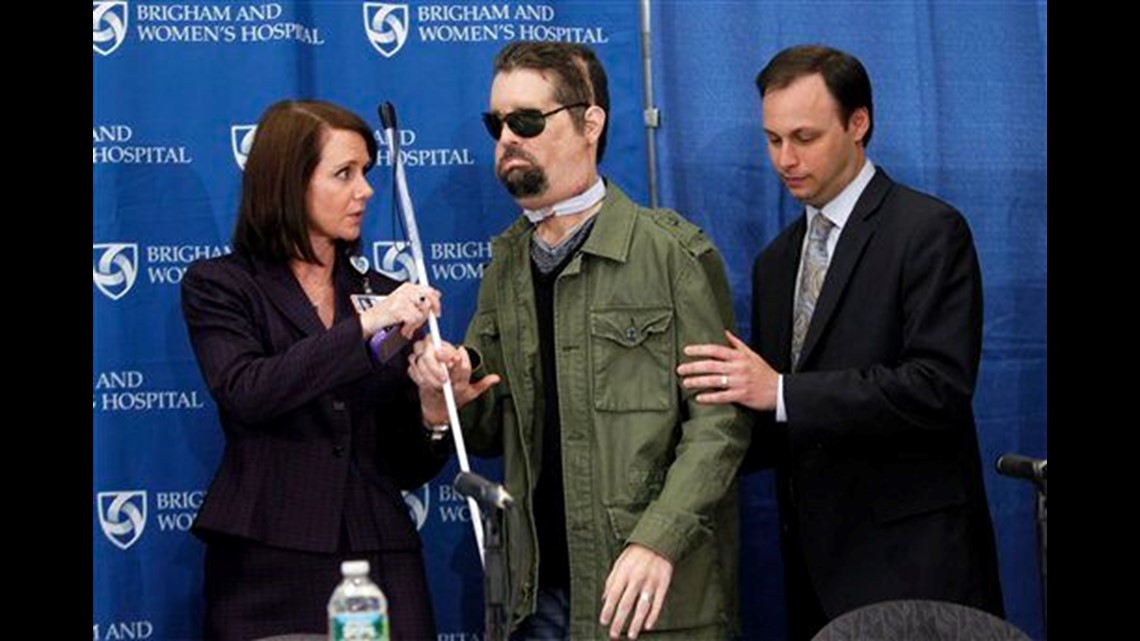 Full face transplant patient makes 1st appearance | cbs8.com