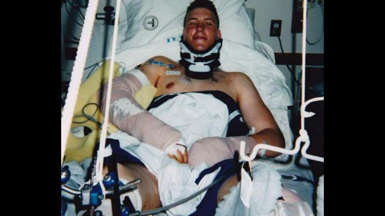 Navy Corpsman amputee shares Veterans Day story of valor | cbs8.com