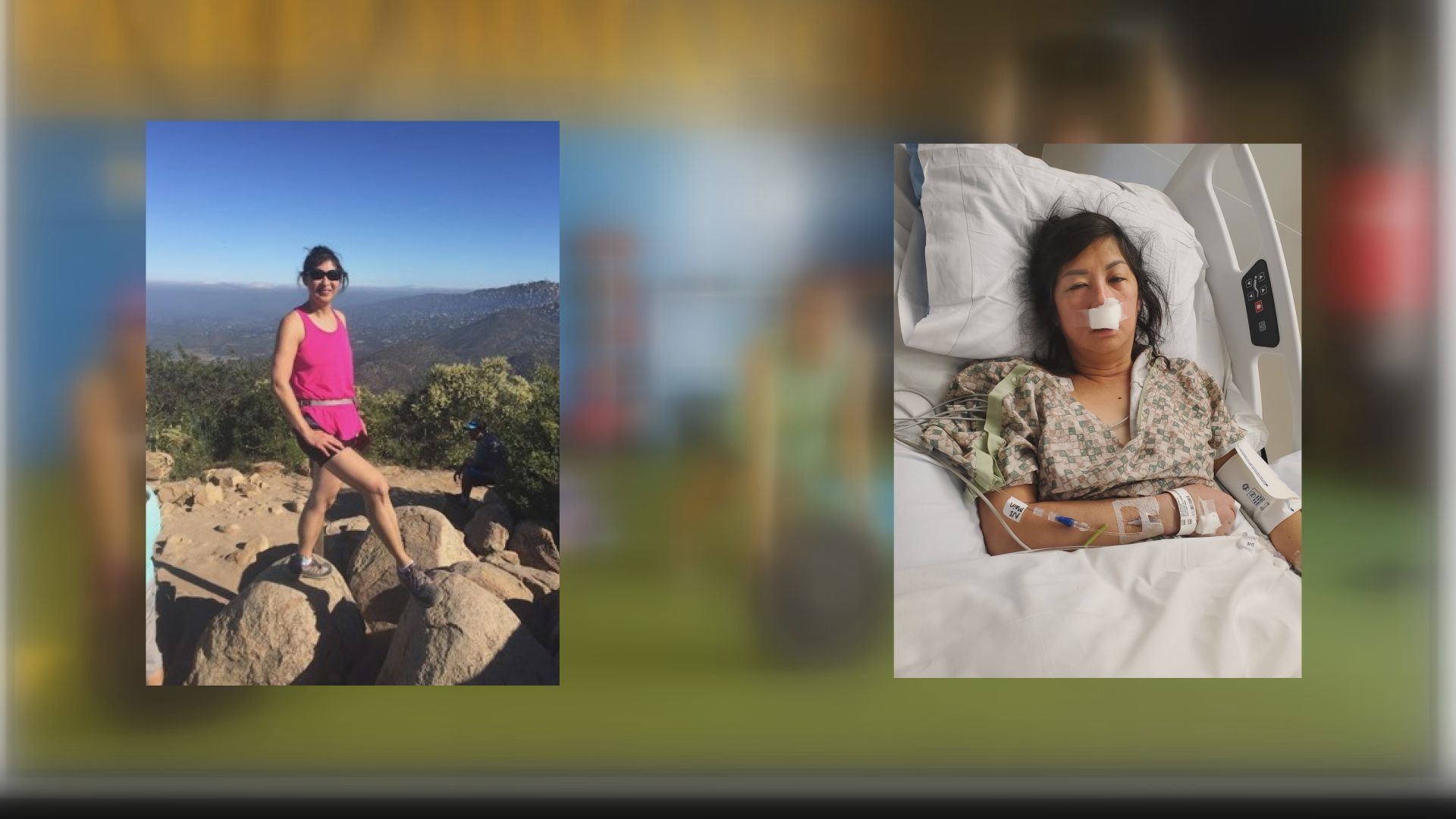Jury awards $18M to San Diego woman partially paralyzed during brain ...