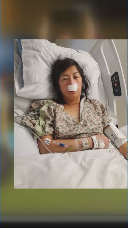 Jury awards $18M to San Diego woman partially paralyzed during brain ...