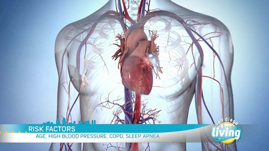 Warning signs and treatment of atrial fibrillation | cbs8.com