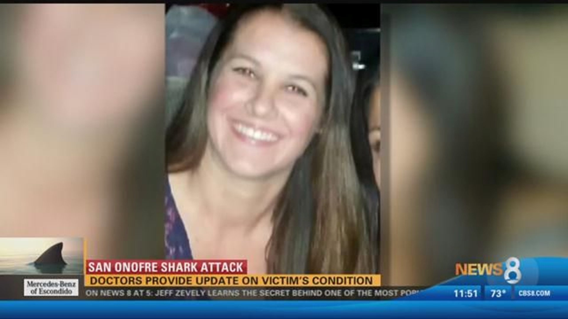 Shark Attack: Doctors say victim is a fighter | cbs8.com