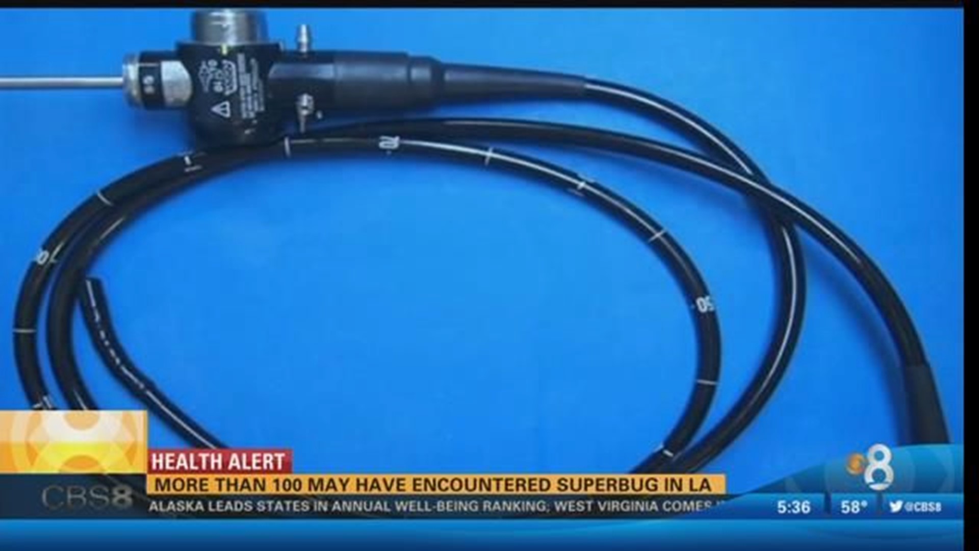 'Superbug' outbreak not threat to LA County public health | cbs8.com