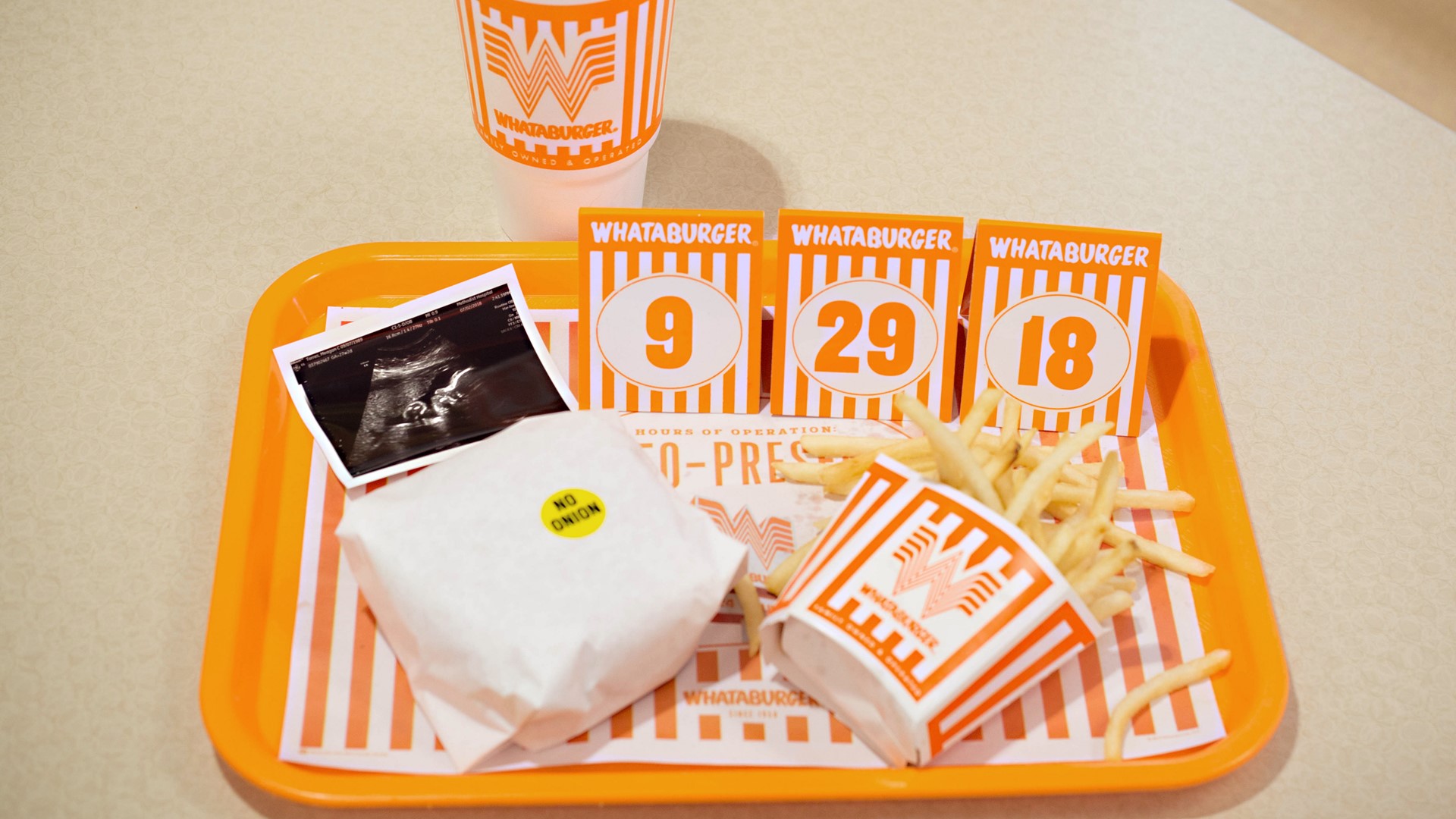Mom poses for adorable maternity photos at Texas Whataburger | cbs8.com