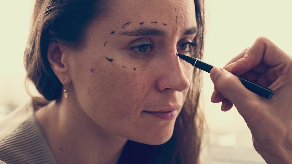 Zoom Dysmorphia: People make permanent face changes | cbs8.com