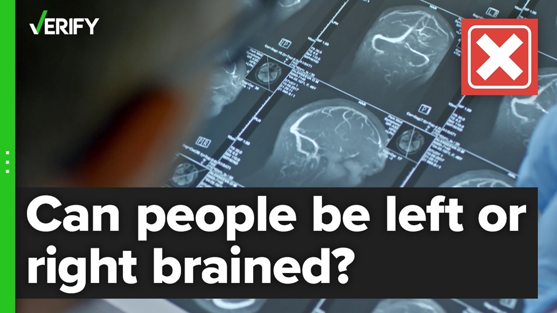 No, people are not either left-brained or right-brained | cbs8.com