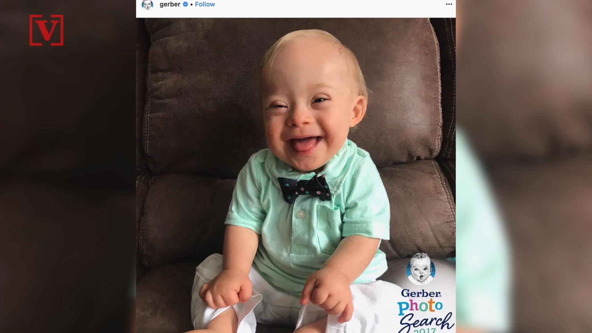 Former Congressman Sean Duffy's daughter born with Down syndrome | cbs8.com