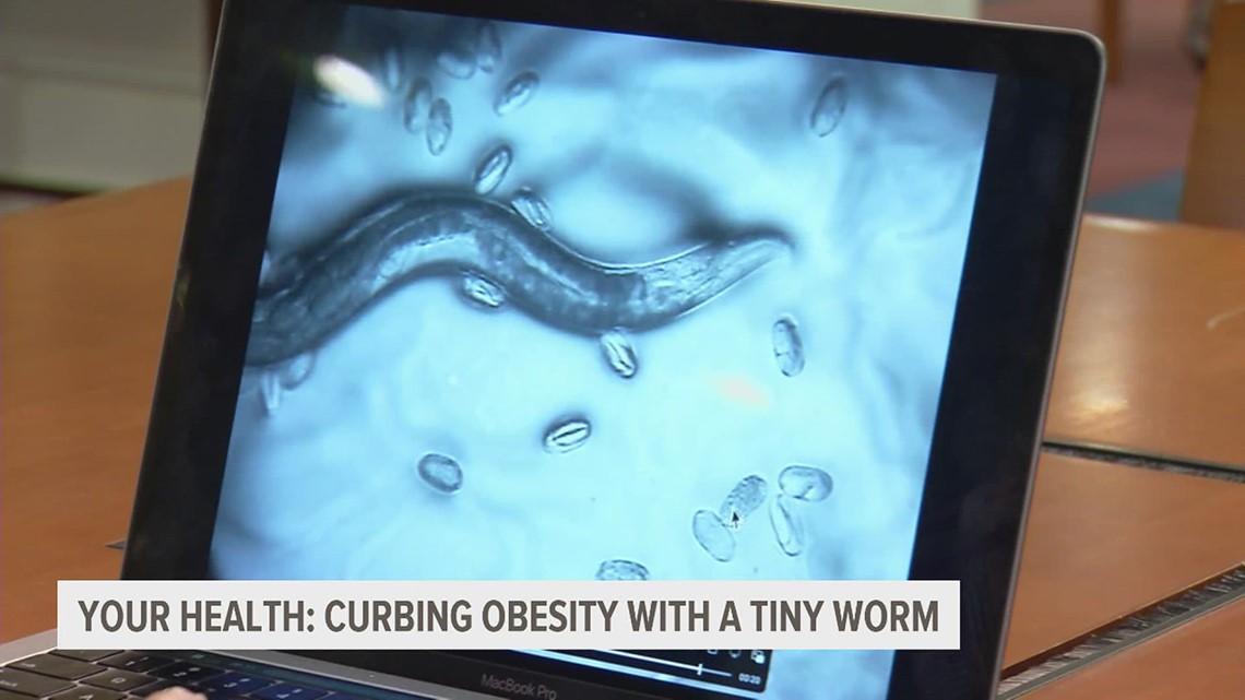 Meet the tiny worm that might hold the key to curbing obesity | cbs8.com