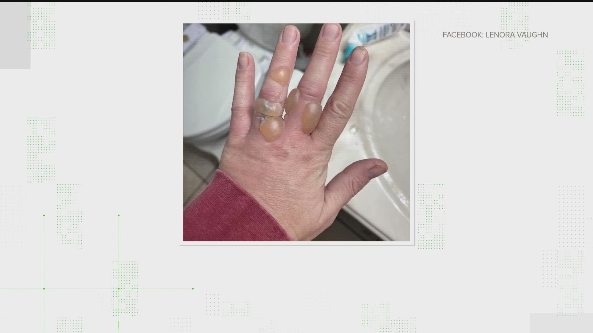 Dermatologist: Lime juice could put your skin in danger | cbs8.com